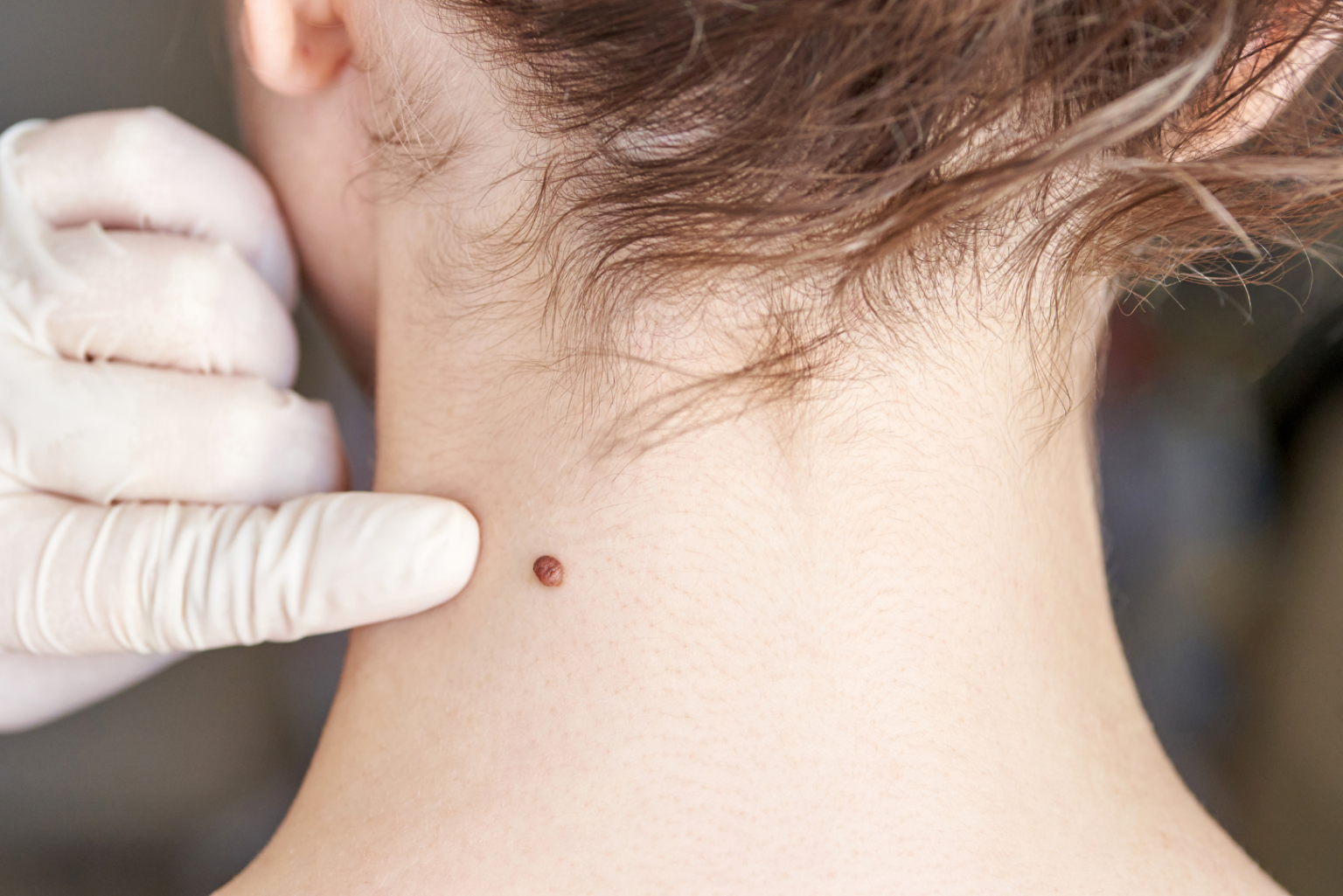 Skin Medics – Dermatology | Skincare & Laser Clinic